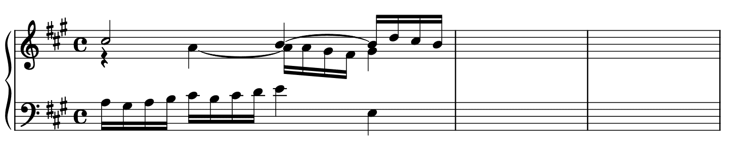 The Leaping Romanesca: Embellishing Three-Part Settings – Essays on Music